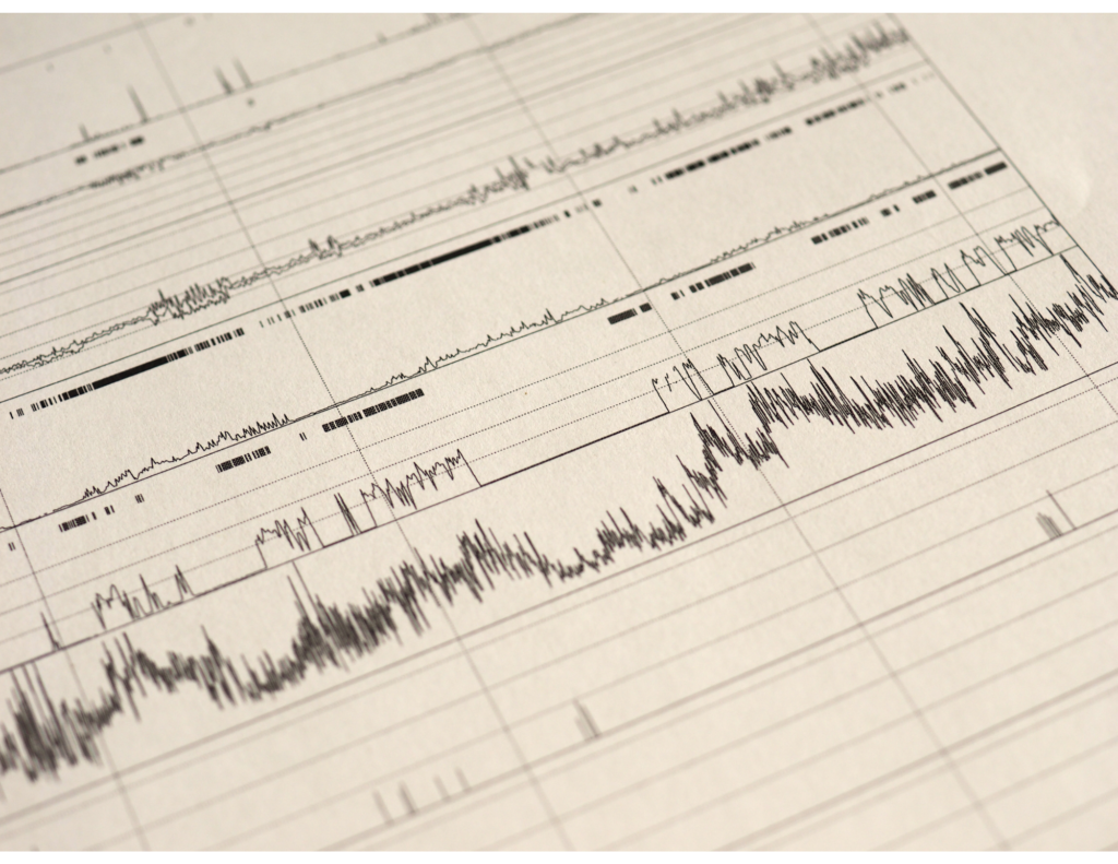 Home Sleep Test (HST / HSAT): What It Is and Where to Get One